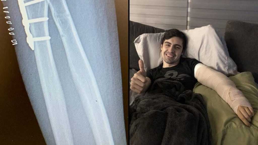 Shroud reveals more detail about his hand injury